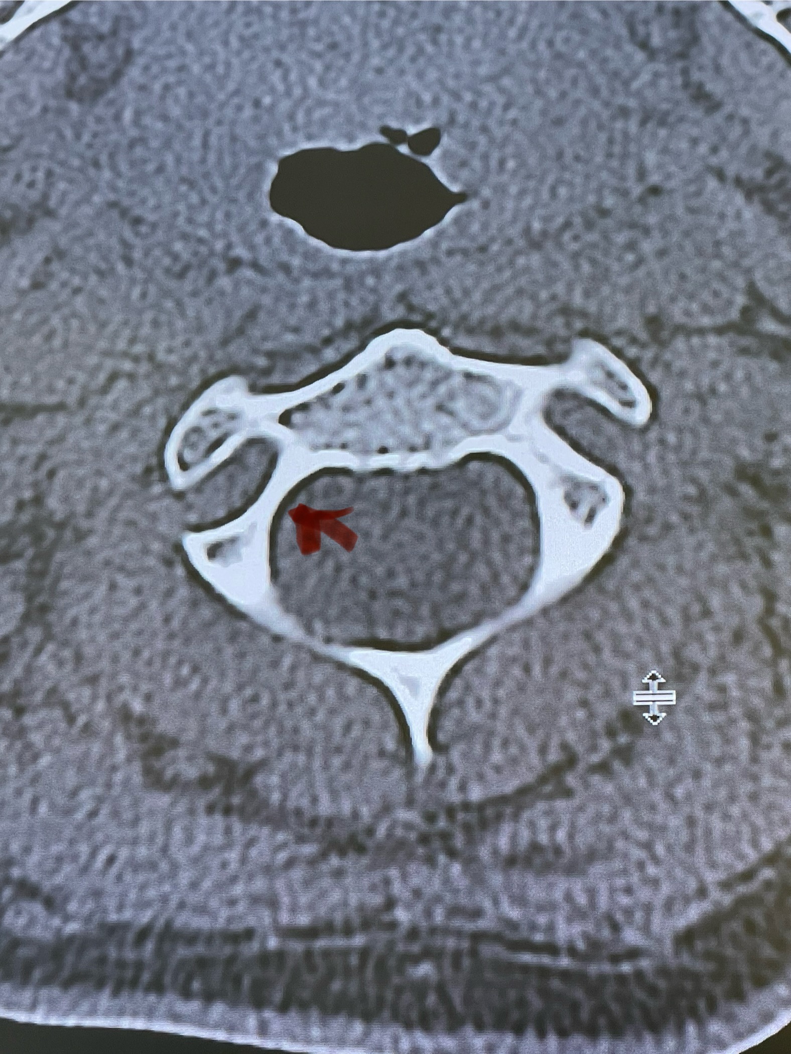 SOMETIMES YOU HAVE TO CONNECT THE SKULL TO THE NECK | NSPC Brain ...