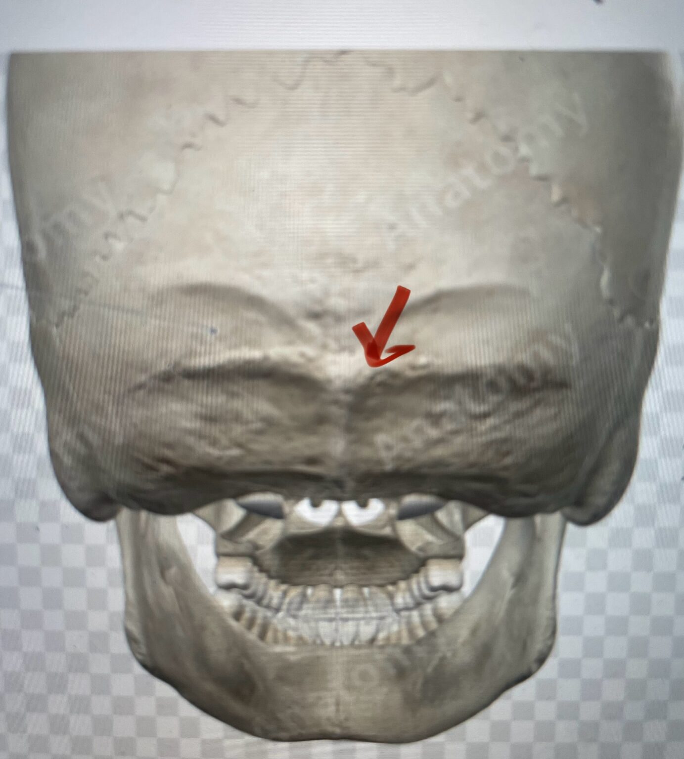 SOMETIMES YOU HAVE TO CONNECT THE SKULL TO THE NECK | NSPC Brain ...